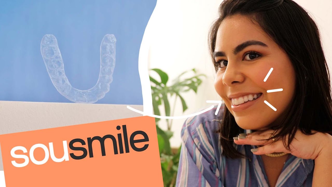 APARELHO INVISÍVEL SOU SMILE - como foi minha experiência usando os ...