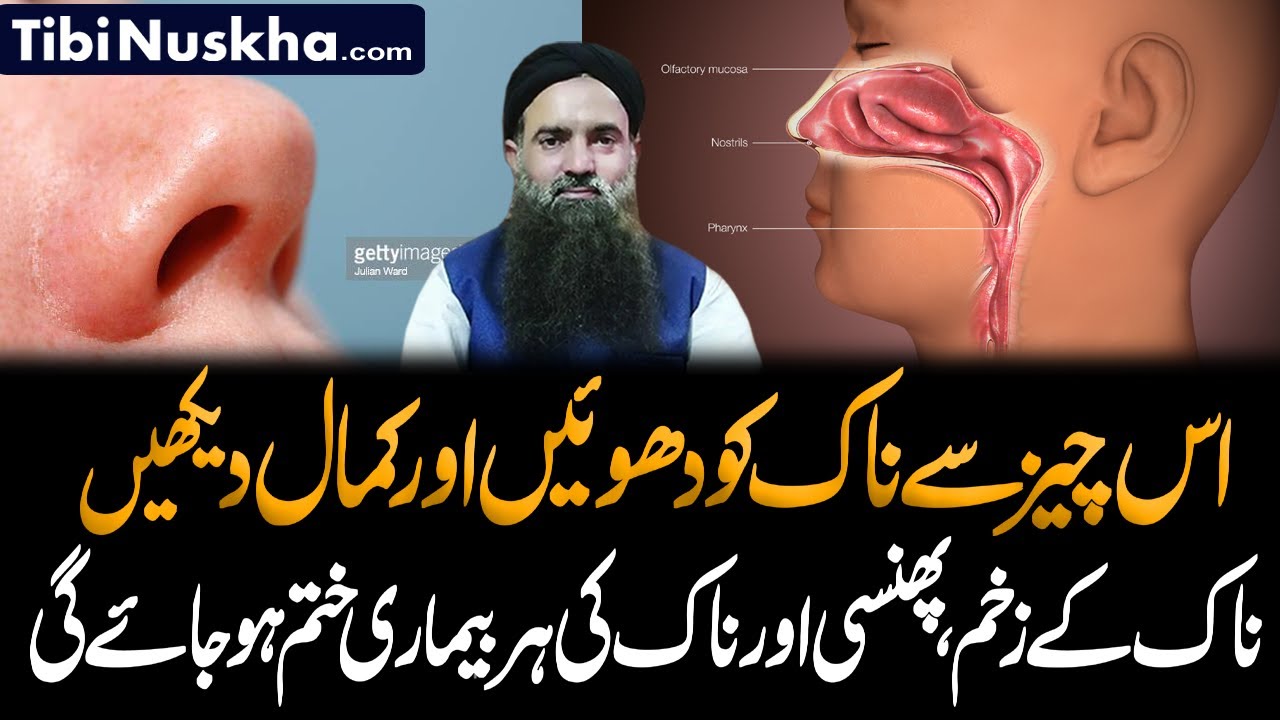 How To Cure A Stuffy Nose ?|| Naak ke zakham ka elaj || Dr Sharafat Ali ...