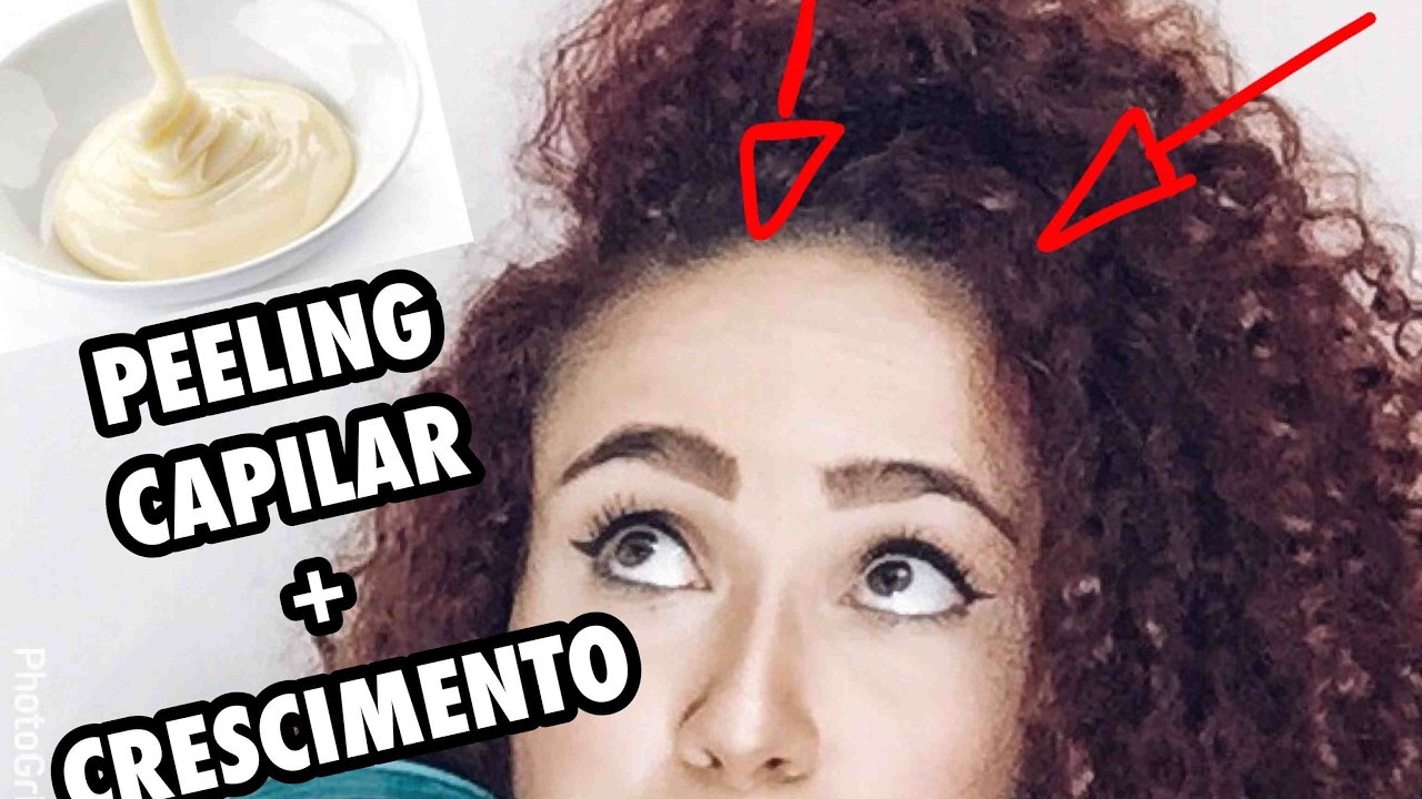 PEELING CAPILAR - RETIRANDO CÉLULAS MORTAS - COMO FAZER E COMO APLICAR ...