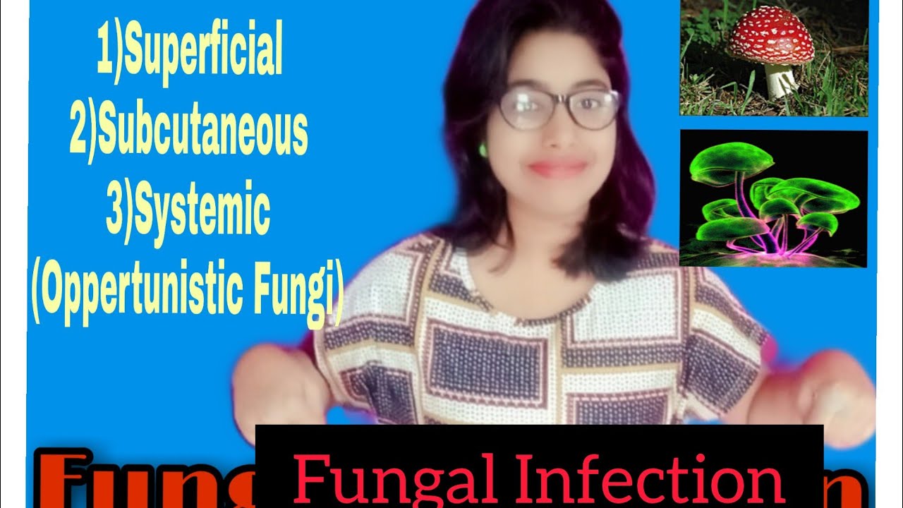 Fungal Infection Classification Part 3Mycology - YouTube