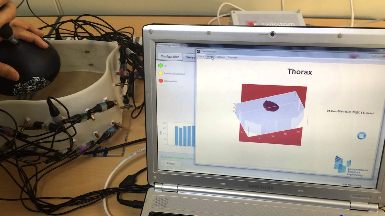 Real-monitoring software by Integrating SWISSTOM EIT-Pioneer Set with ...