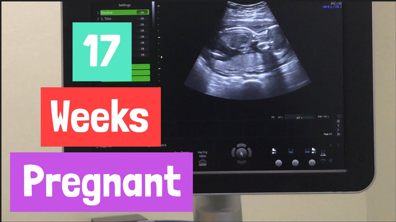 17 weeks Ultrasound + Placenta Previa Marginalis - YouTube