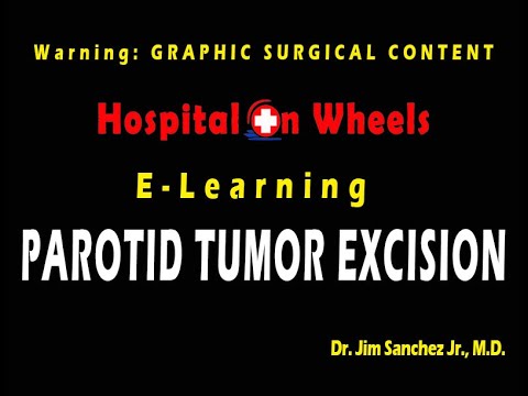 HOW E-Learning: Parotid Tumor Excision - YouTube