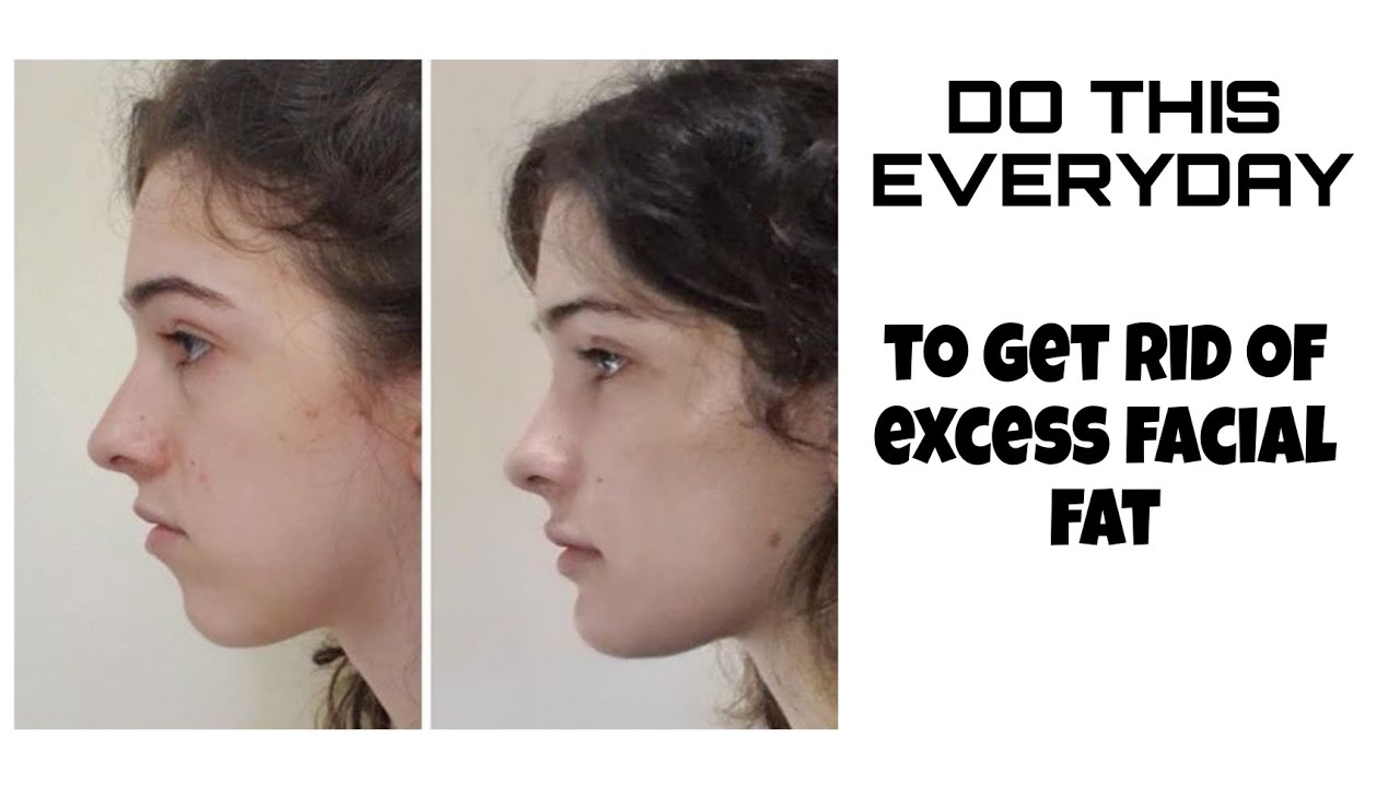 Do this 1 week,to get rid of excess facial fat! - YouTube
