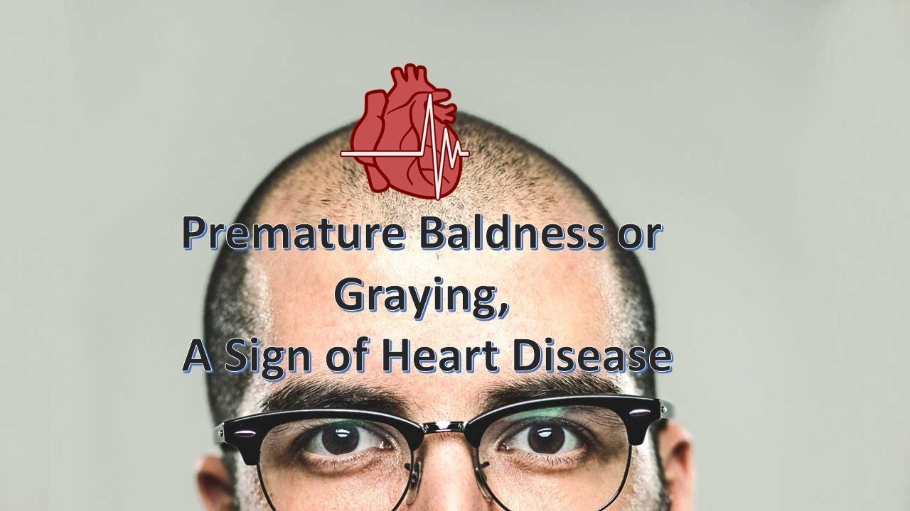 Premature Baldness or Graying, A Sign of Heart Disease - YouTube