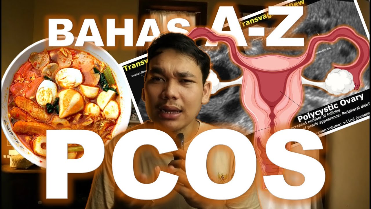 PCOS Ciri-ciri dan Tanda Gejala Dijelaskan dgn Mudah oleh Dokter ...