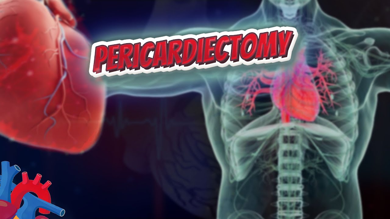 Pericardiectomy - Human Heart and Cardiology ️ ️ ️🔊 - YouTube