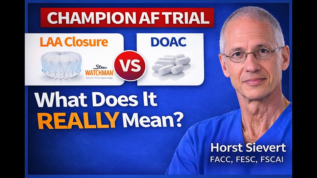 CHAMPION AF Explained: LAA Closure vs DOAC — Interpretation, Limits ...