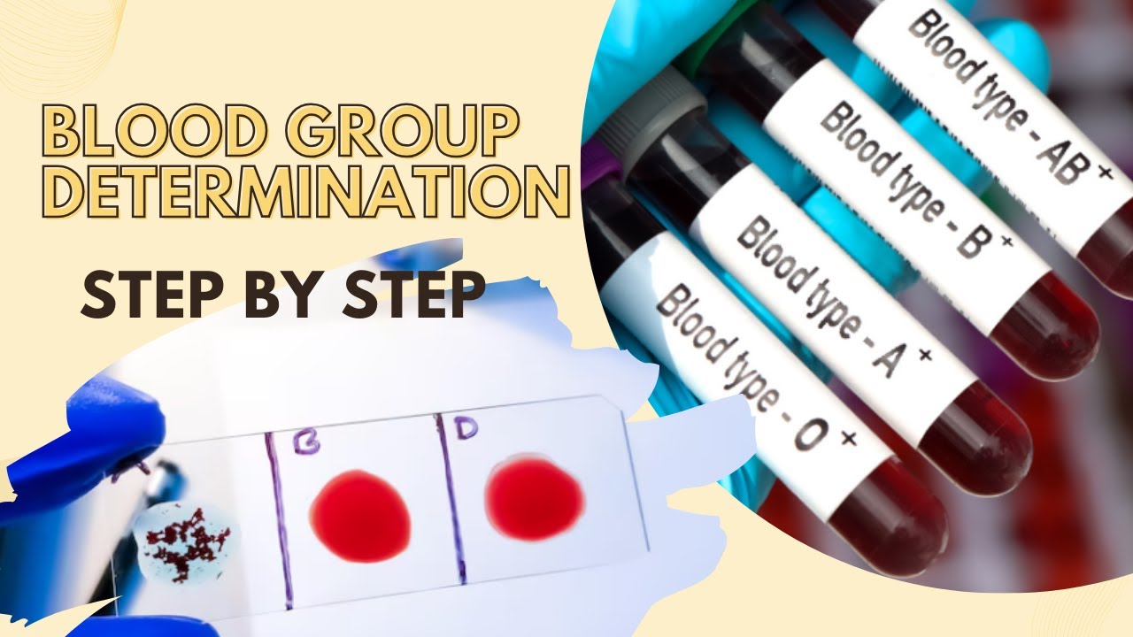 blood group determination step by step - YouTube