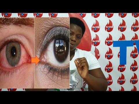 IBYO KURYA BYAGUFASHA KUGIRA AMASO AREBA NEZA N'IBYO WAKORA NGO WIRINDI UBURWAYI BWAYO