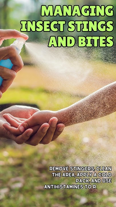 Wilderness First Aid Basics: Managing Insect Stings and Bites - YouTube