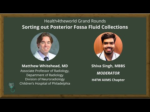 Sorting out Posterior Fossa Fluid Collections - YouTube