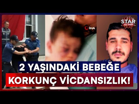 Kan Donduran Vicdansızlık! 2 Yaşındaki Bebeğe Bunu Nasıl Yaptınız? | Star Ana Haber
