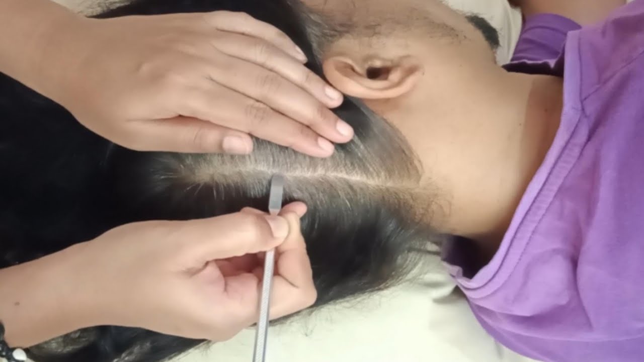 Scalp Check & Treatment ASMR - For Stress Relief & Sleep - YouTube