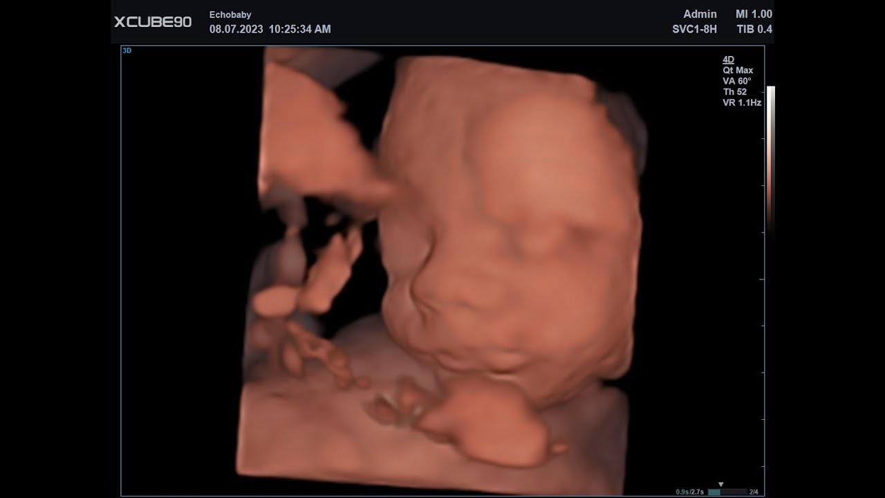 Echo 27 Weken 3D Foto's - YouTube