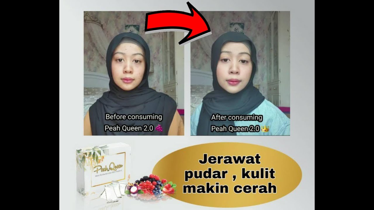 Peah Queen 2.0 Review Product Dan Testimoni - YouTube
