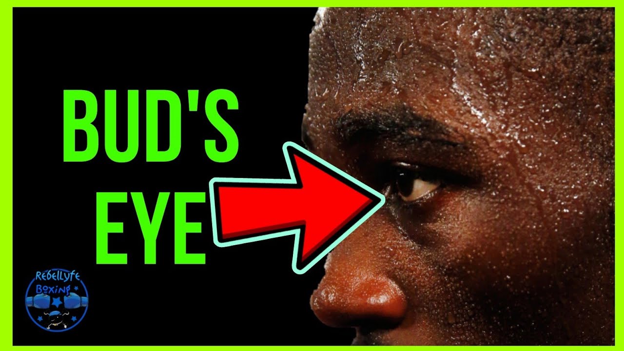 Terence Crawford Eye Will Get Broken By Errol Spence #errolspencejr # ...