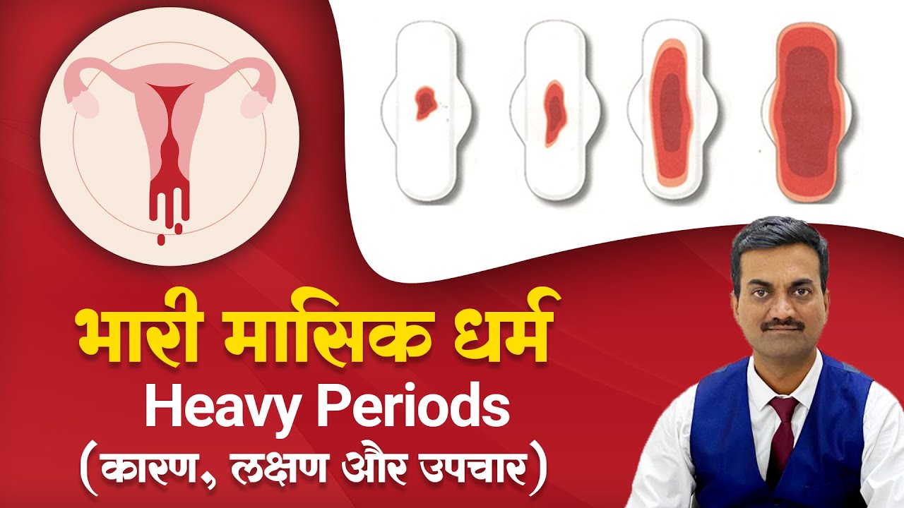 भारी मासिक धर्म :कारण, लक्षण और उपचार|Dr.Avinash Deore| Heavy Periods ...