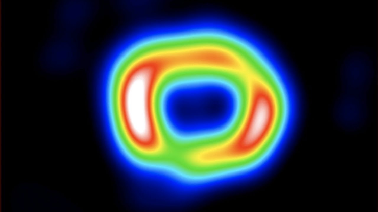 Supernova 1987A time-lapse - YouTube