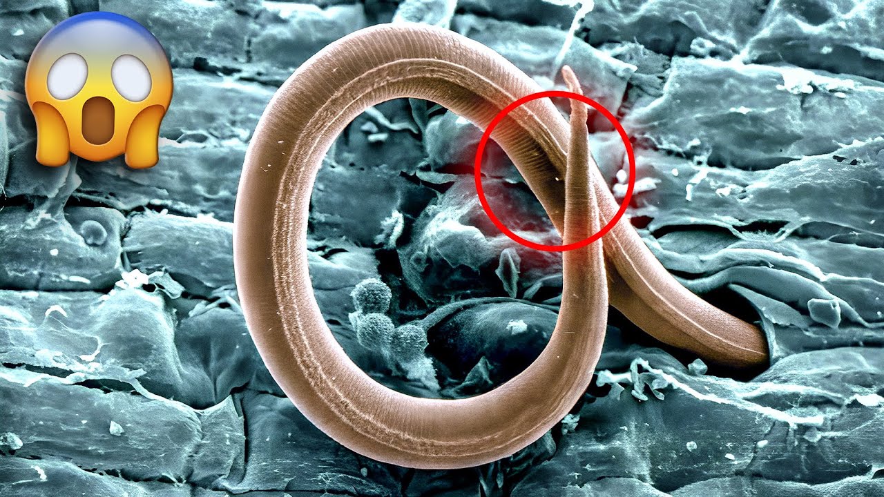 This Ancient Worm Was Frozen for 46,000 Years… and Came Back to Life ...