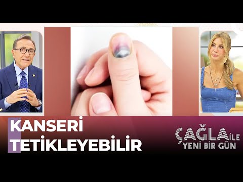 Tırnak Kırılmasını Nasıl Önleyebiliriz? - Çağla ile Yeni Bir Gün 1038. Bölüm