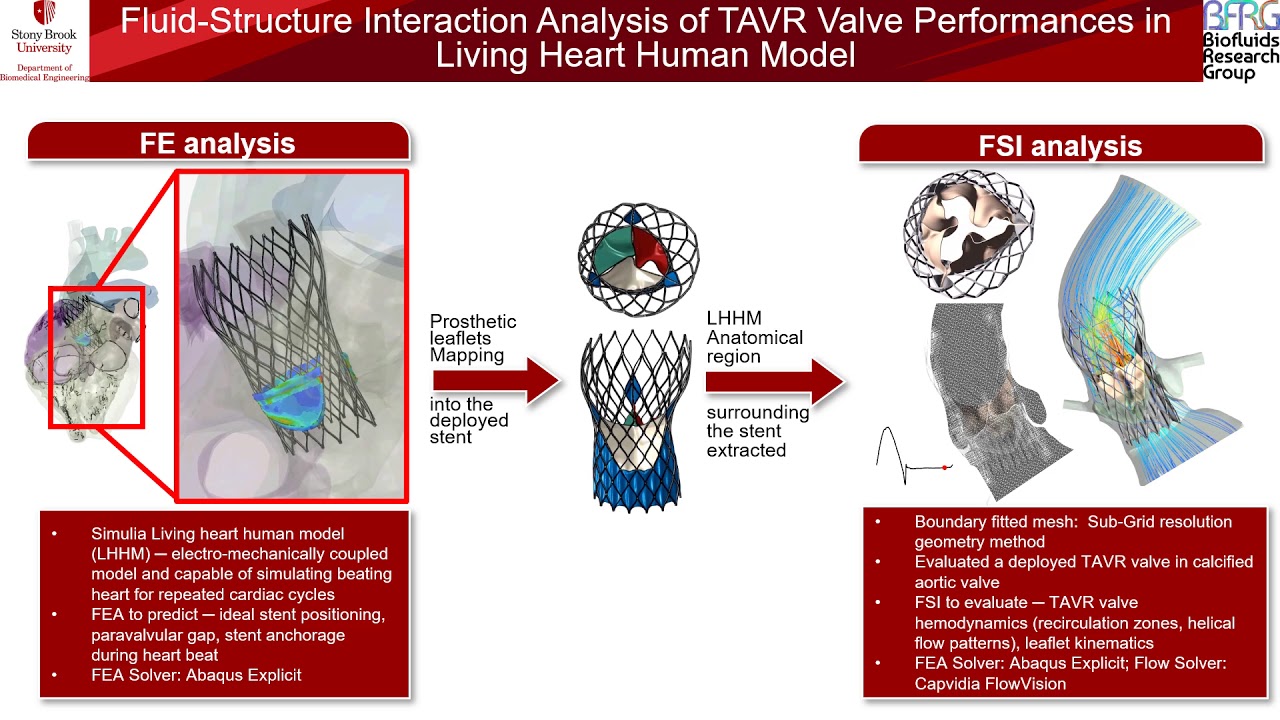 FSI Analysis of TAVR Valve Performances in Living Heart - YouTube