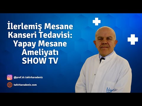 İlerlemiş Mesane Kanseri Tedavisi: Yapay Mesane Ameliyatı