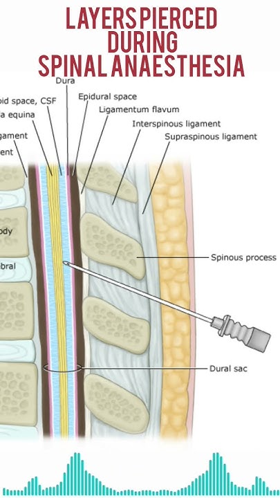 STRUCTURE PIERCED DURING SPINAL ANAESTHESIA 🔥 - YouTube