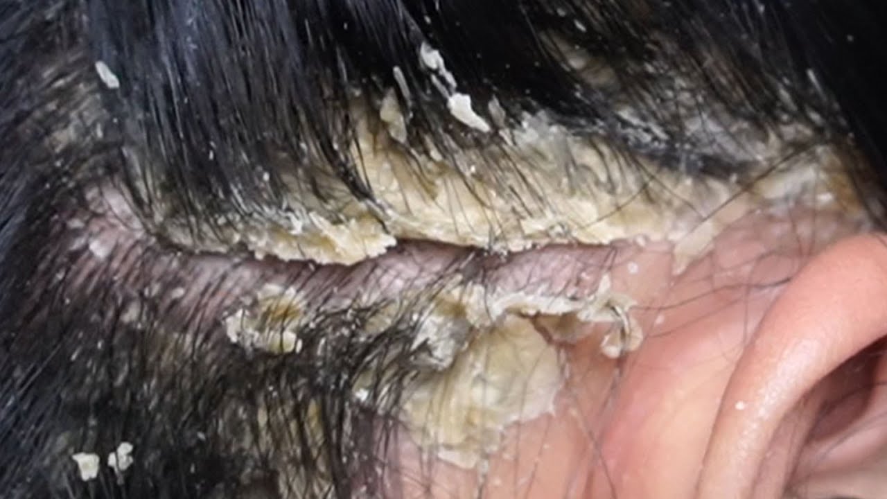 𝙍𝙚𝙡𝙖𝙭𝙞𝙣𝙜 𝘾𝙡𝙚𝙖𝙣𝙨𝙞𝙣𝙜 𝙛𝙤𝙧 𝙖 𝙋𝙚𝙖𝙘𝙚𝙛𝙪𝙡 𝙈𝙞𝙣𝙙 with Comb #355 - YouTube