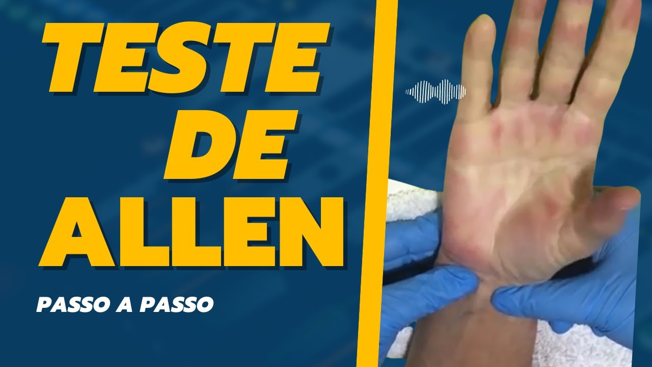 Como Fazer o Teste de Allen antes da Punção Arterial? # ...