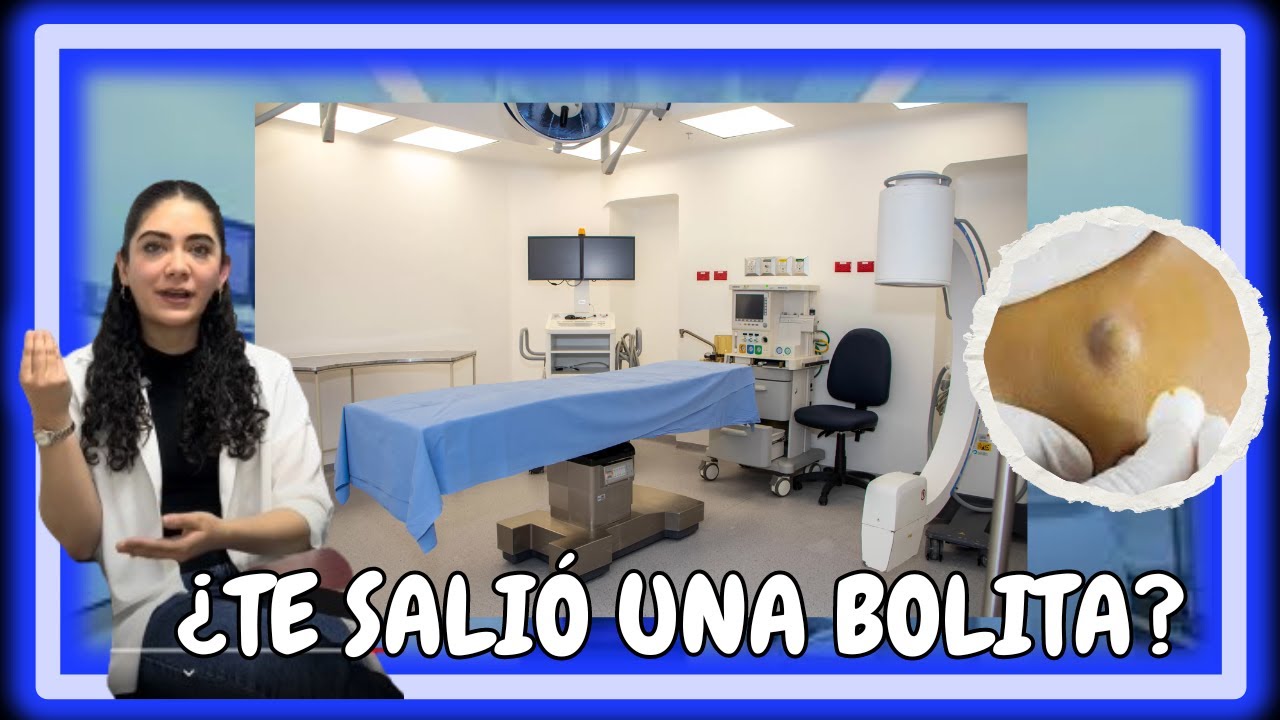 QUISTE EPIDÉRMICO: Es PROBABLE que necesites CIRUGÍA I JAVIER DERMA I ...