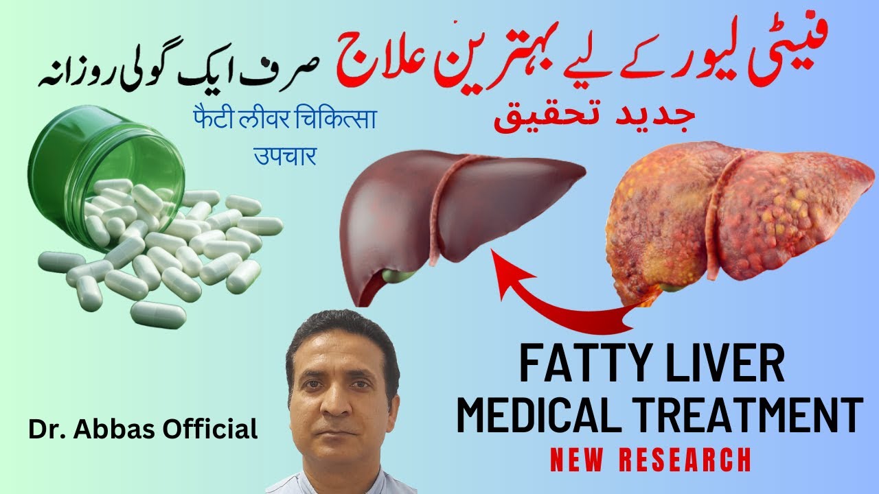 Fatty Liver: Medical Treatment of Fatty Liver #fattylivertreatment # ...