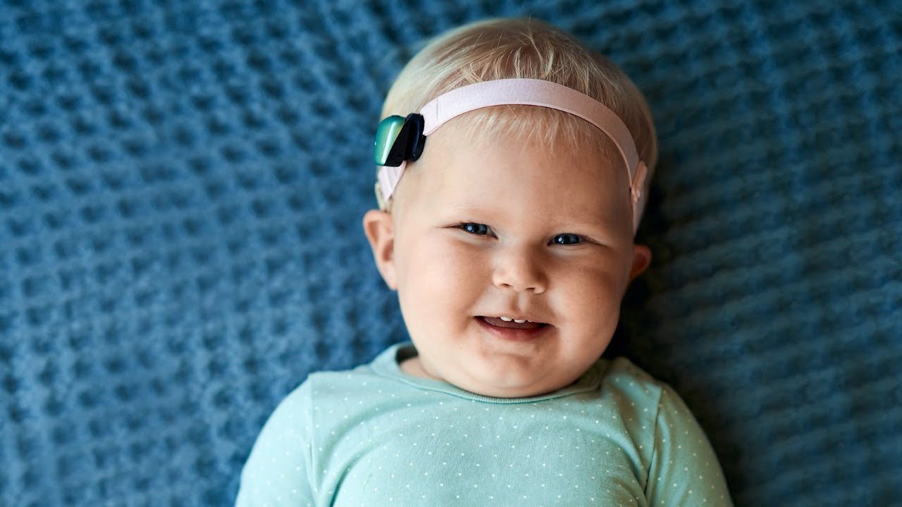 How Cochlear Baha Start works - YouTube