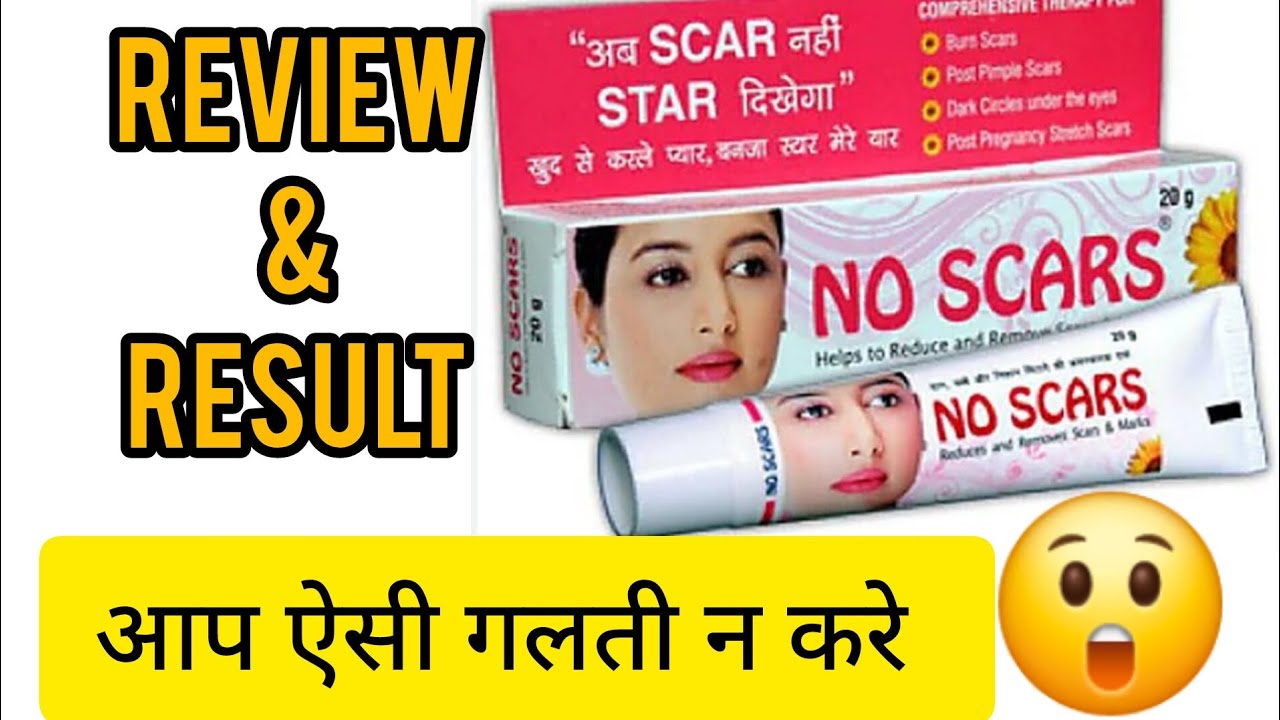 NO SCARS Cream Review & Result | Brightening /Whitening Cream | नो ...