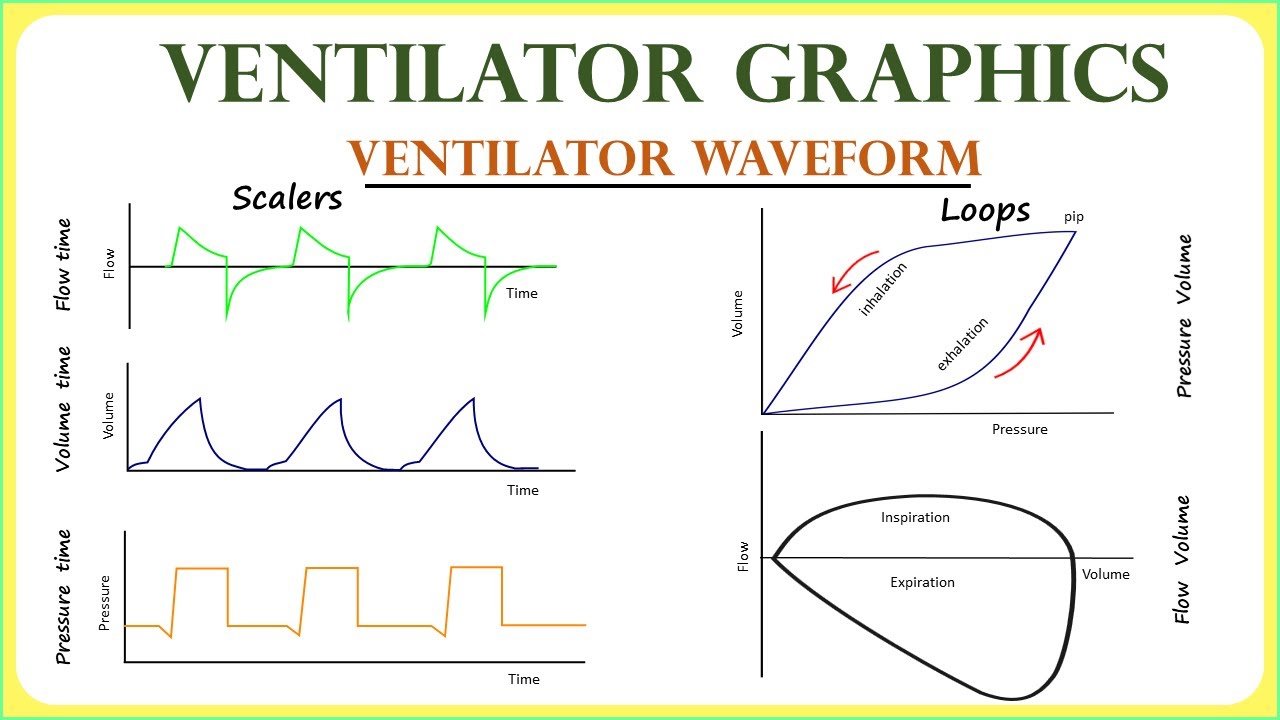 Ventilator waveform (full video)#mechanicalventilation #anesthesiology #criticalcaremedicine ...