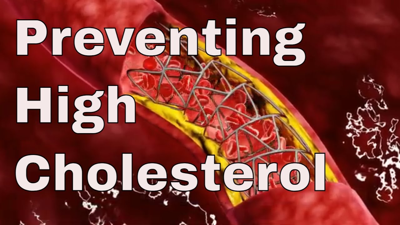 Preventing High Cholesterol: Tips for a Healthy Lifestyle #cholesterol ...