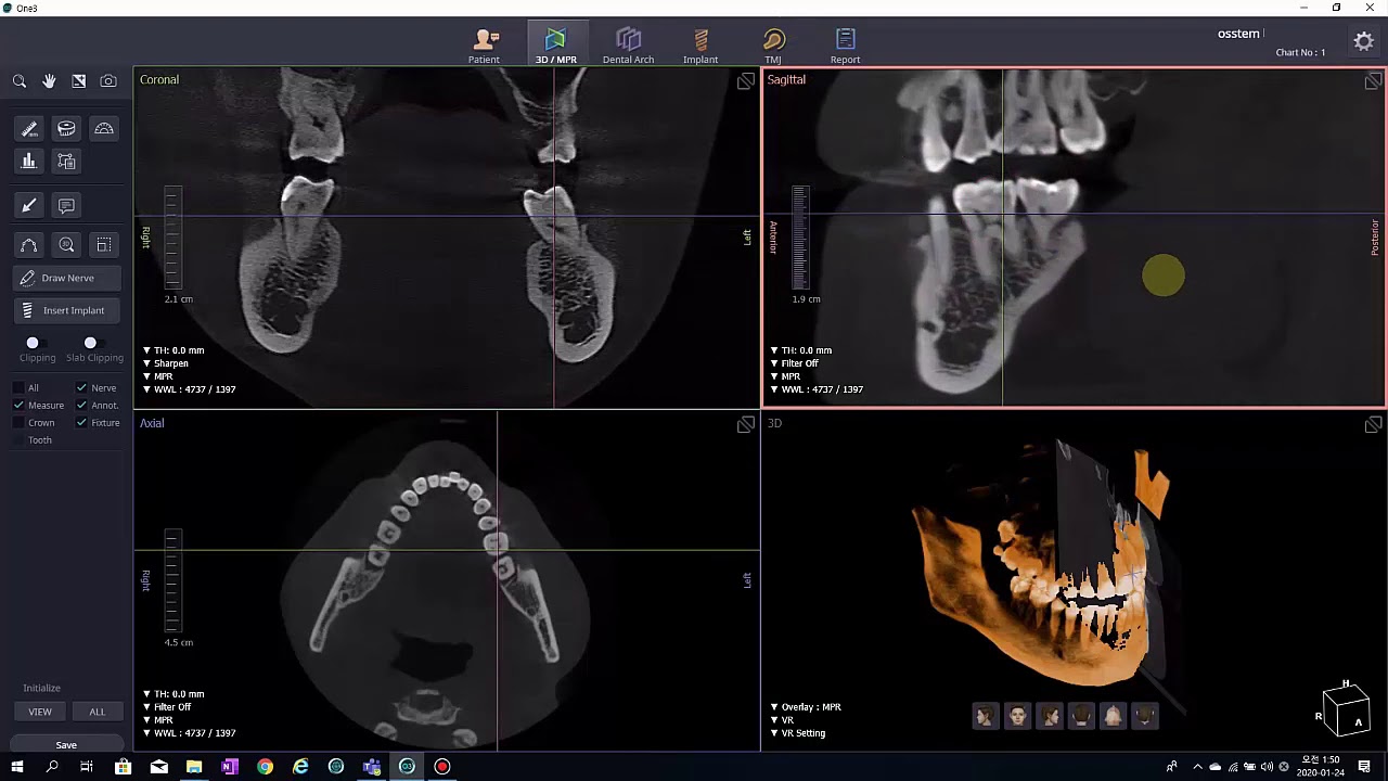 [One3] 3D/MPR 편 - YouTube