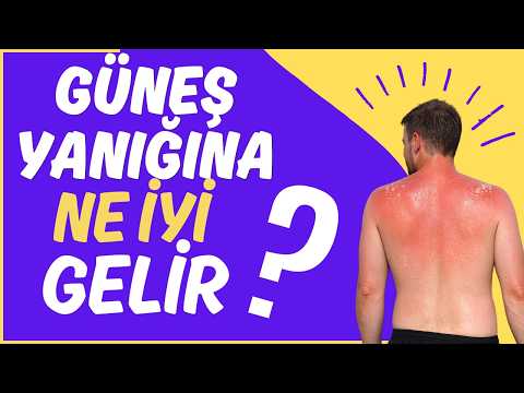 Güneş Yanığına Ne İyi Gelir? | Evde Uygulanabilecek Doğal Yöntemler