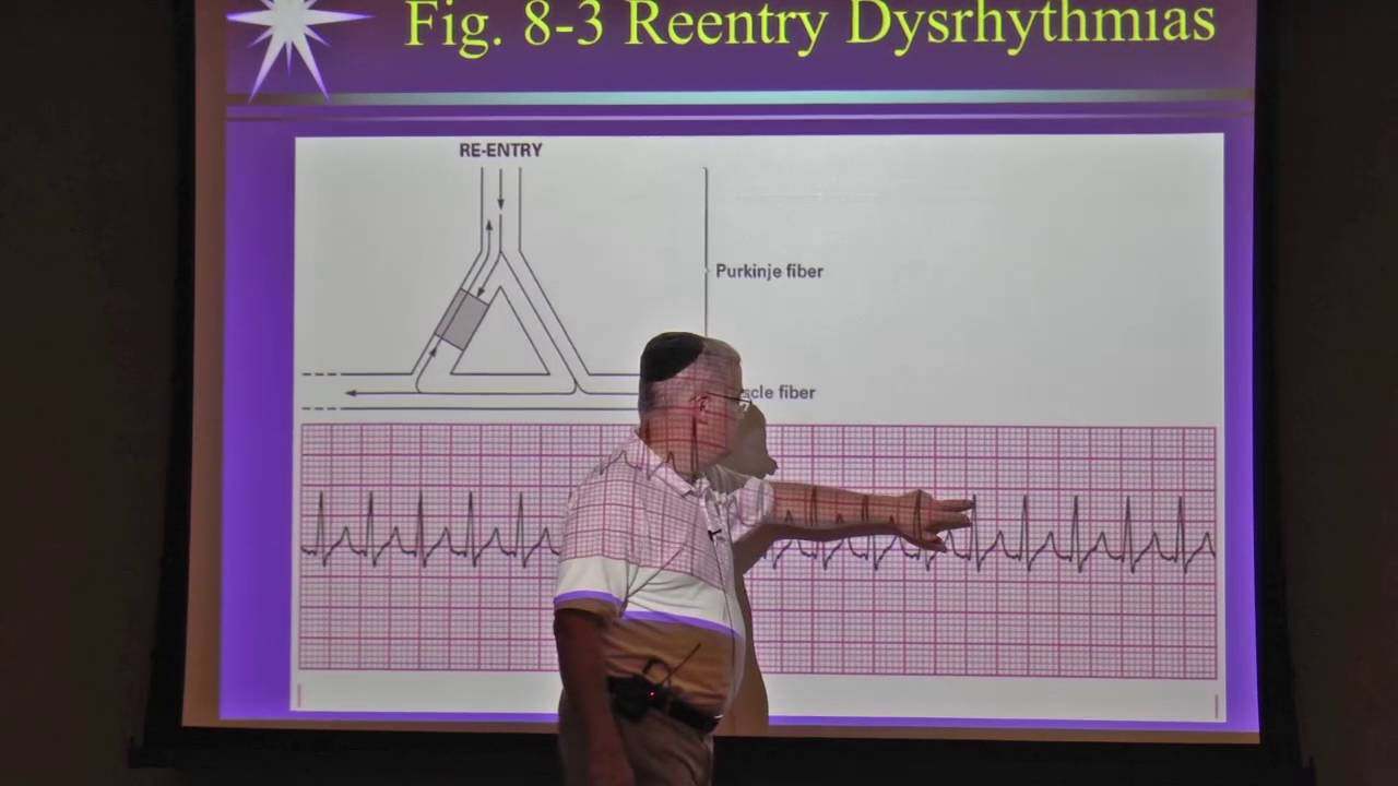 Basic EKG interpretation for EMT's CME Lecture 2 - Part 2 - YouTube