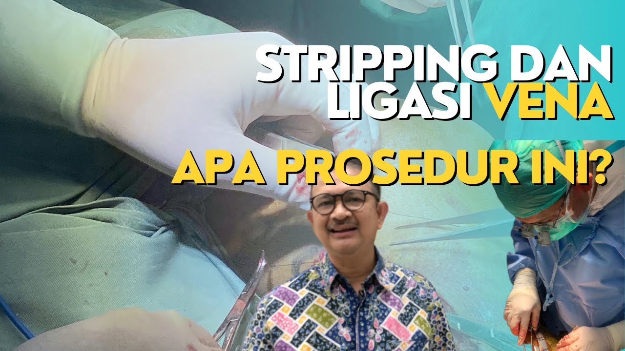 STRIPPING + LIGASI VENA UNTUK VARISES? APA ITU? - YouTube