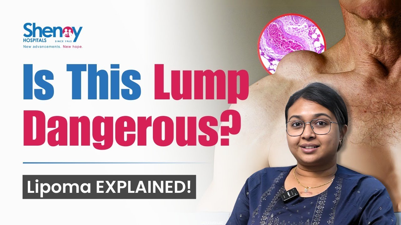 Don’t Ignore This Lump: It Could Be More Than Just Fat! | Lipoma ...