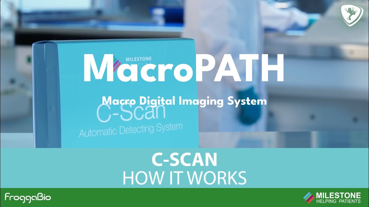 MacroPATH - Macro Digital Imaging System - C-SCAN - How it works - YouTube