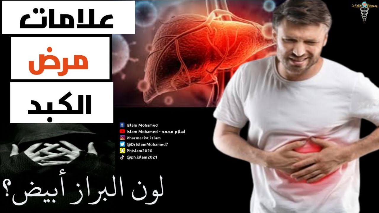 لون البراز ابيض؟ علامات مرض الكبد Youtube