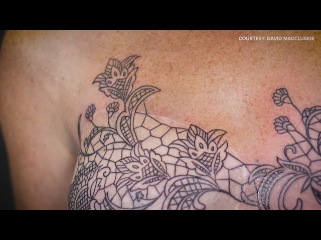 Reconstruction Tattoos