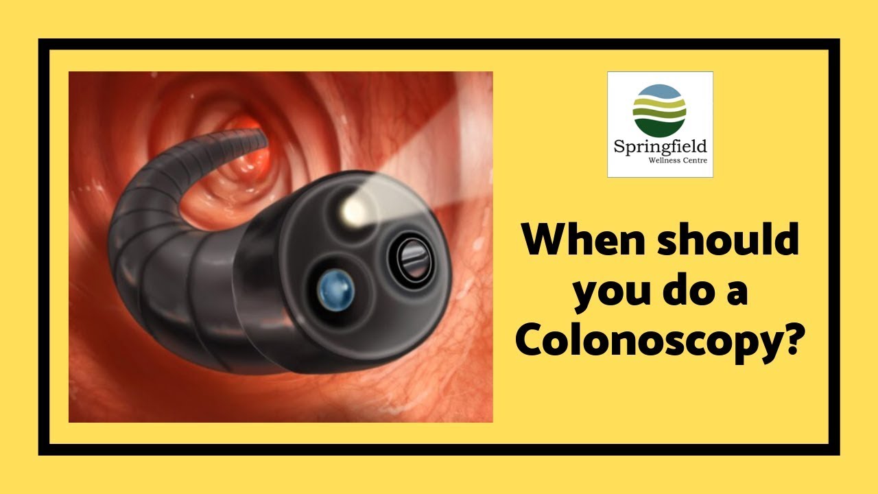 When Should You Do A Colonoscopy In Medical Terms What Are The