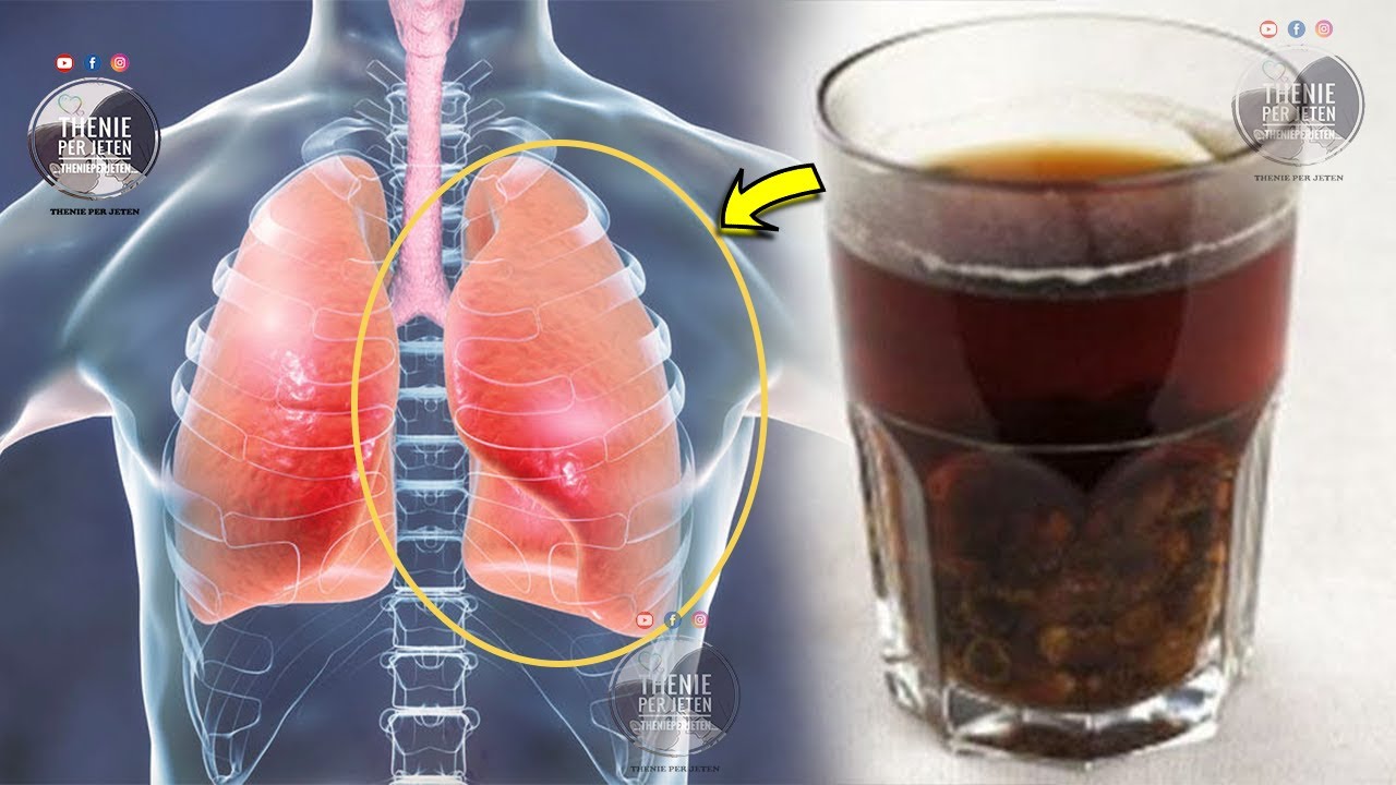 Nxjer nga fyti dhe mushkeritë gelbazën, 9 recet natyrale që ju bën të ...