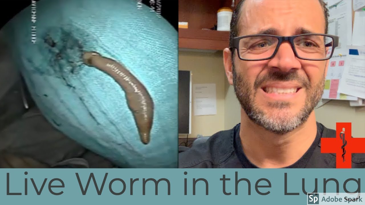 live worm in lungs - YouTube