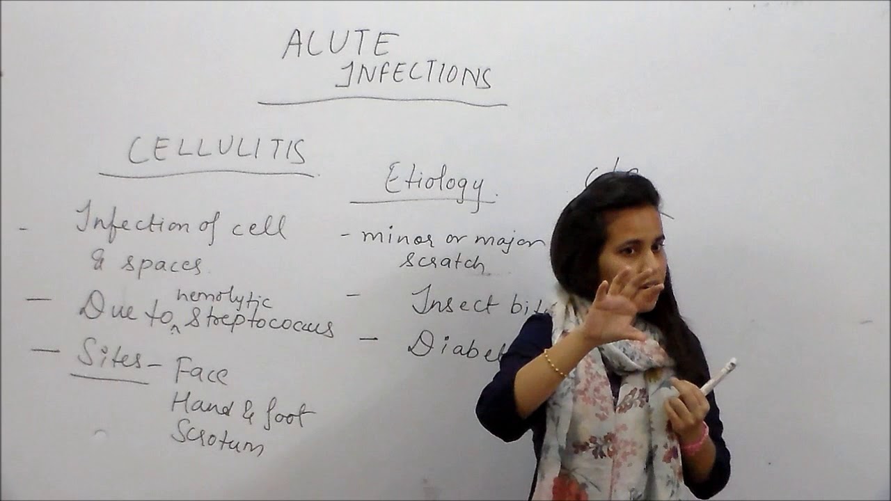 Cellulitis Acute Infection Of Cell Ludwig Angina Acute Carbuncle Furuncle Ludwig Boil