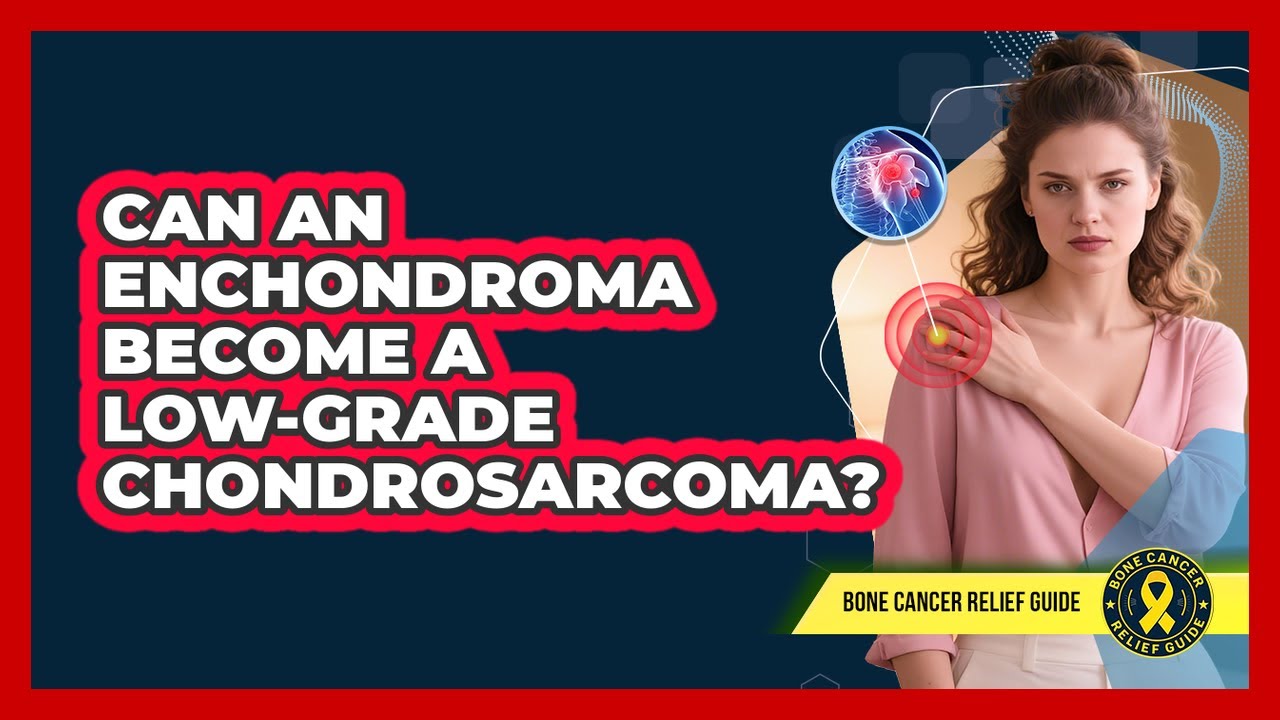 Can An Enchondroma Become A Low-grade Chondrosarcoma? - Bone Cancer ...