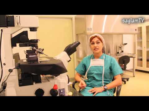 Doktor Fidan Hesenova. Ginekoloq. Sonsuzluğun çarəsi. Sonsuzluğun müalicəsi.